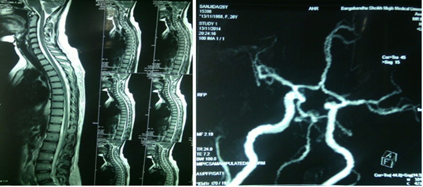 Figure 2. MRI Screening of whole spine and MRA of cerebral vessels ...