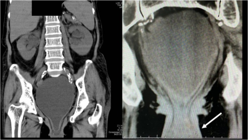 Figure 1. Whole-body computed tomography (CT) on arrival. CT indicates ...