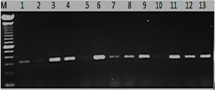 Figure 1. PCR amplification. Lane M: DNA ladder (100bp), Lane 1: LSKB08 ...