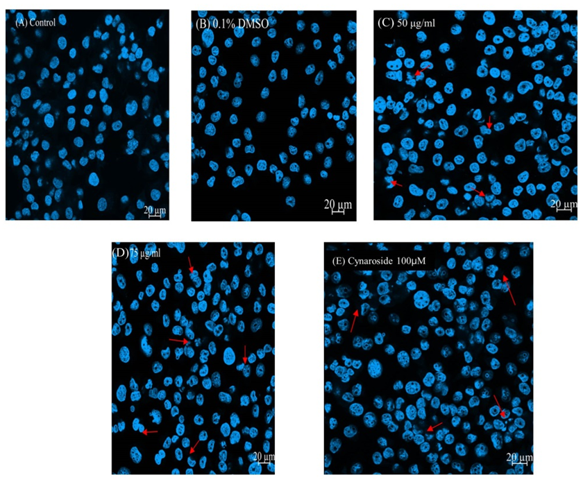Figure 9. DAPI staining of apoptotic bodies of PANC-1 cells. Cells were ...